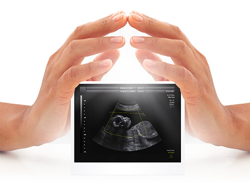 Cand se vede inima bebelusului la ecografie - Clubul Bebelusilor